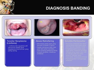 Abses peritonsilar | PPTX