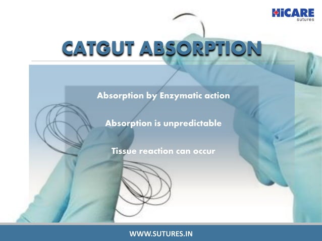 Types of Absorbable Sutures | PDF