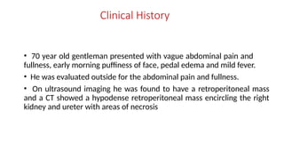 ABSTPI case presentation of retroperitoneal tumor | PPTX