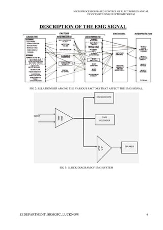 EMG electromayogram | DOCX