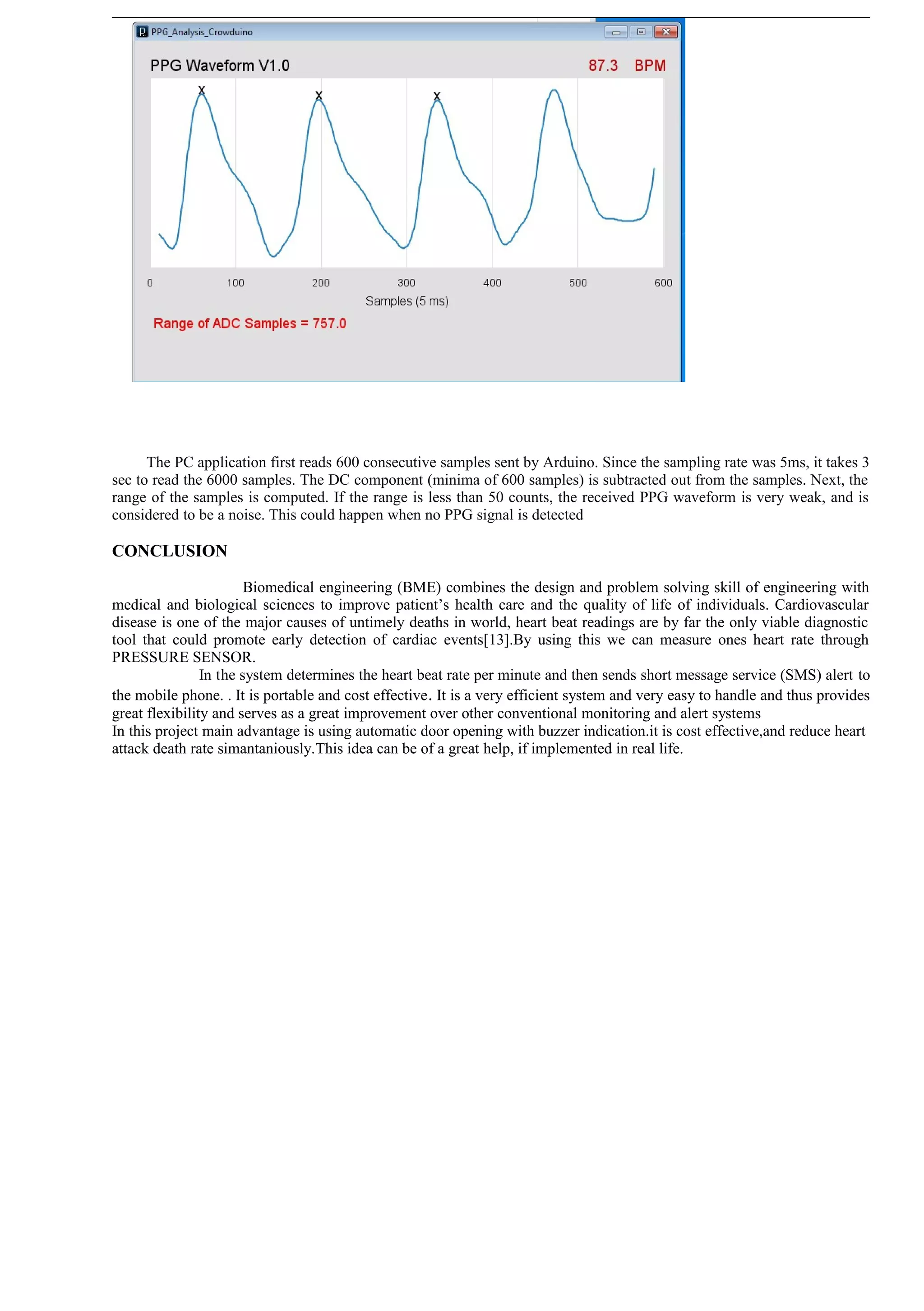 Heart attact detect and monitoring system via arduino. | DOC