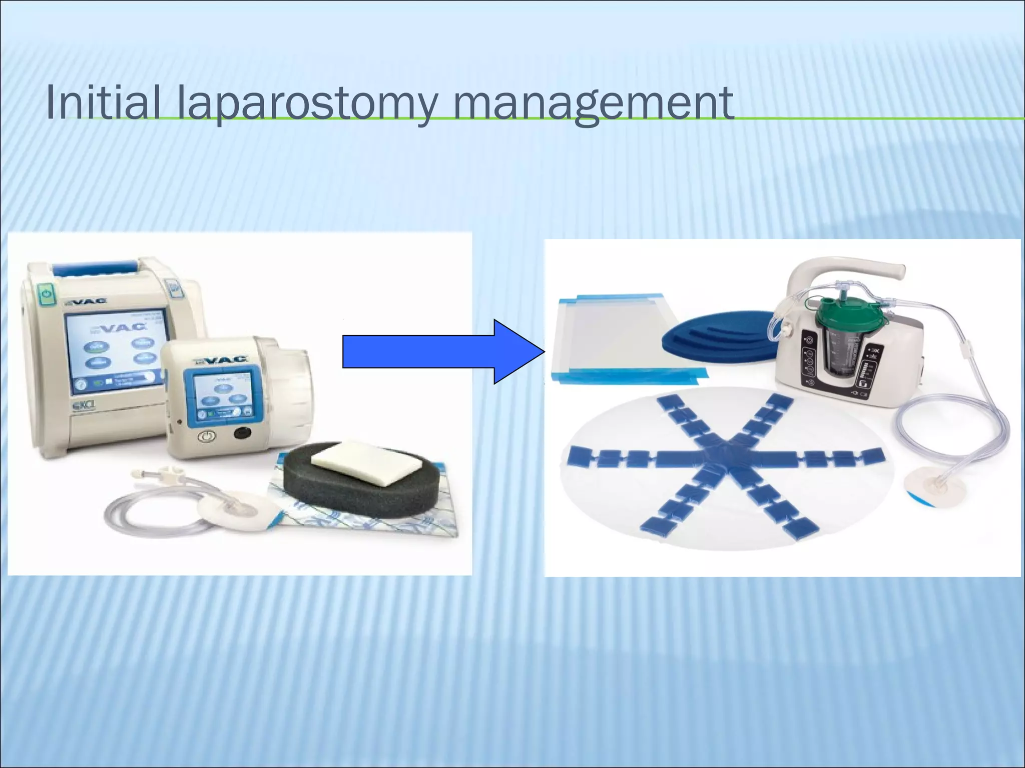 Laparostomy management - ABThera™ Open Abdomen Negative Pressure ...