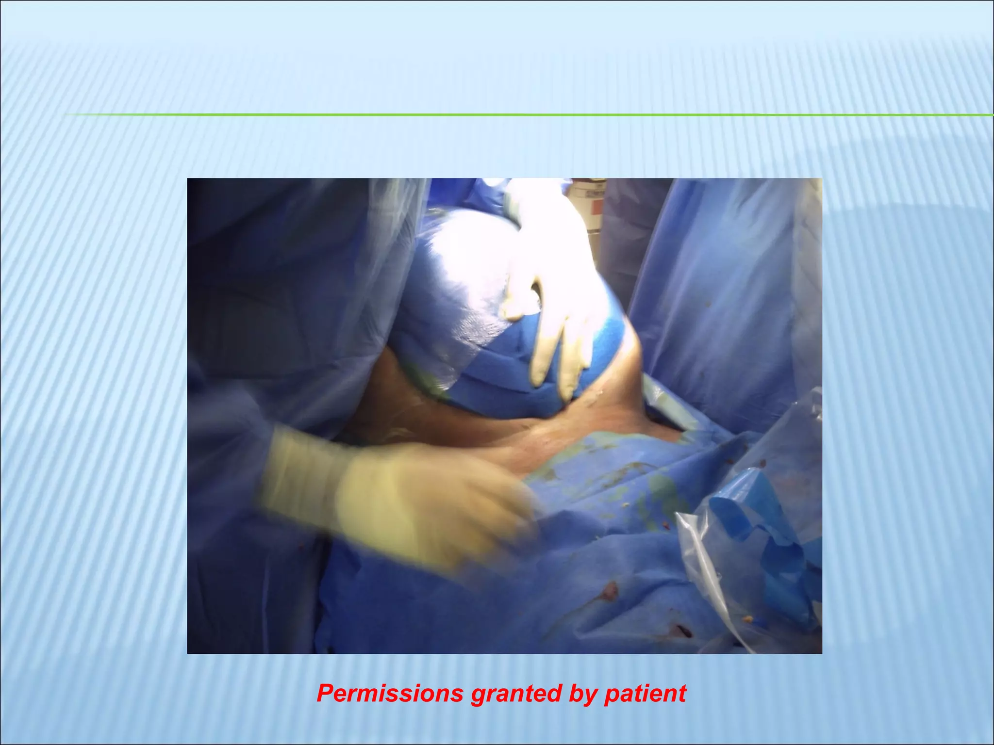 Laparostomy management - ABThera™ Open Abdomen Negative Pressure Therapy System in a Grade IV ...