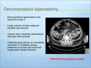 Laparostomy management - ABThera™ Open Abdomen Negative Pressure ...