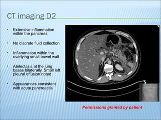 Laparostomy management - ABThera™ Open Abdomen Negative Pressure ...