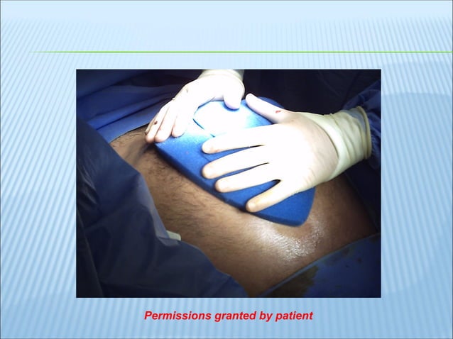 Laparostomy management - ABThera™ Open Abdomen Negative Pressure ...