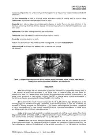 Hypodontia in Permanent Dentition in Patients with Cleft Lip and Palate | PDF | Dental Health ...