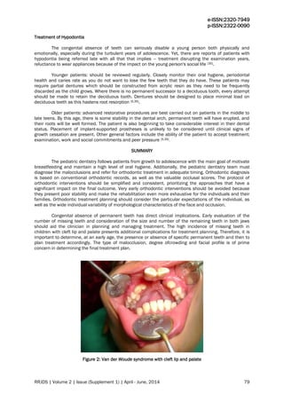 Hypodontia Of Permanent Teeth