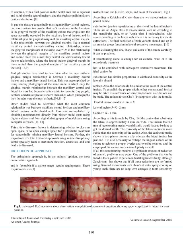Congenitally Missing Lateral Incisors; Orthodontic, Restorative, and ...