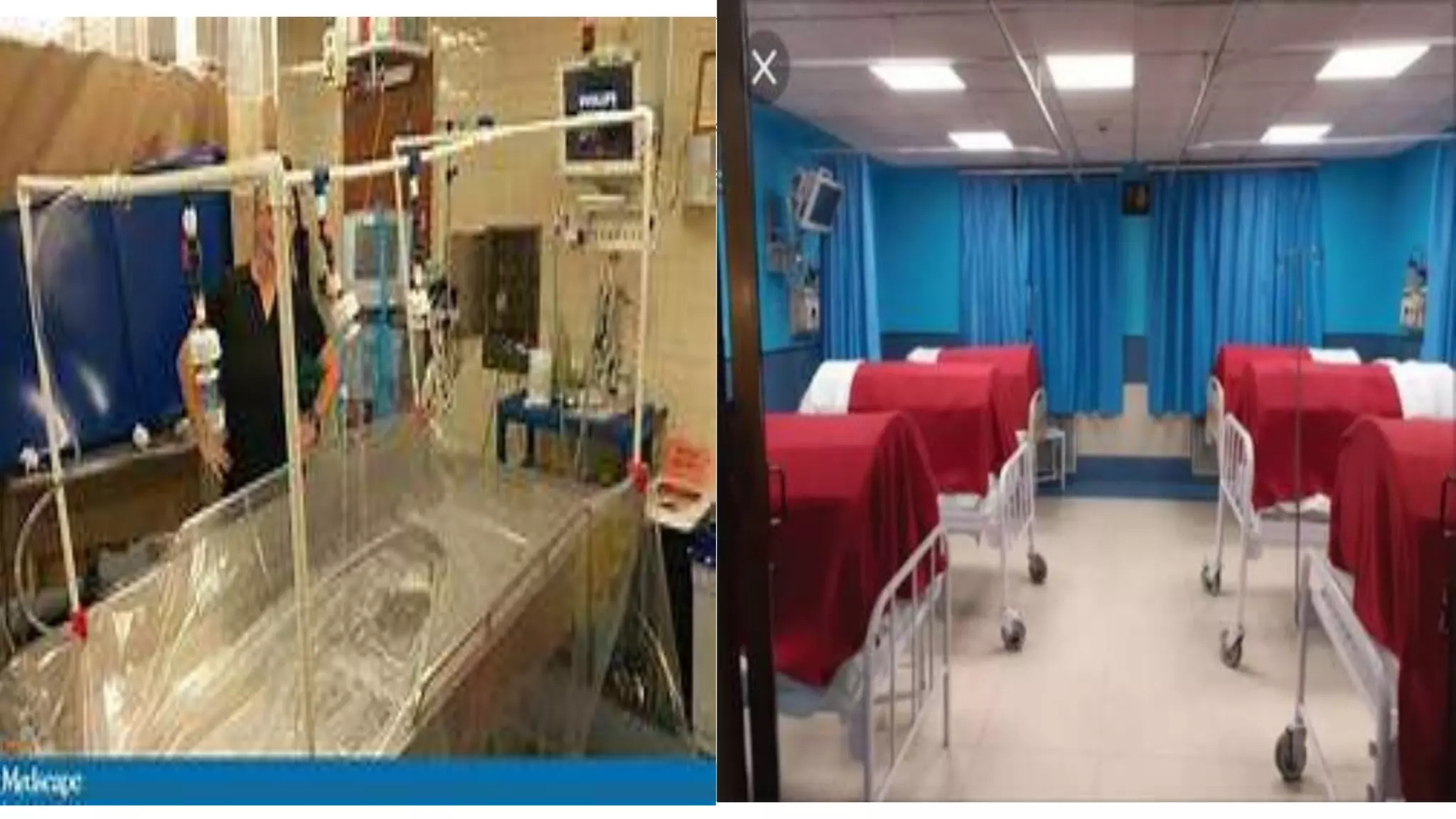 Nursing management of burn patient | PPTX