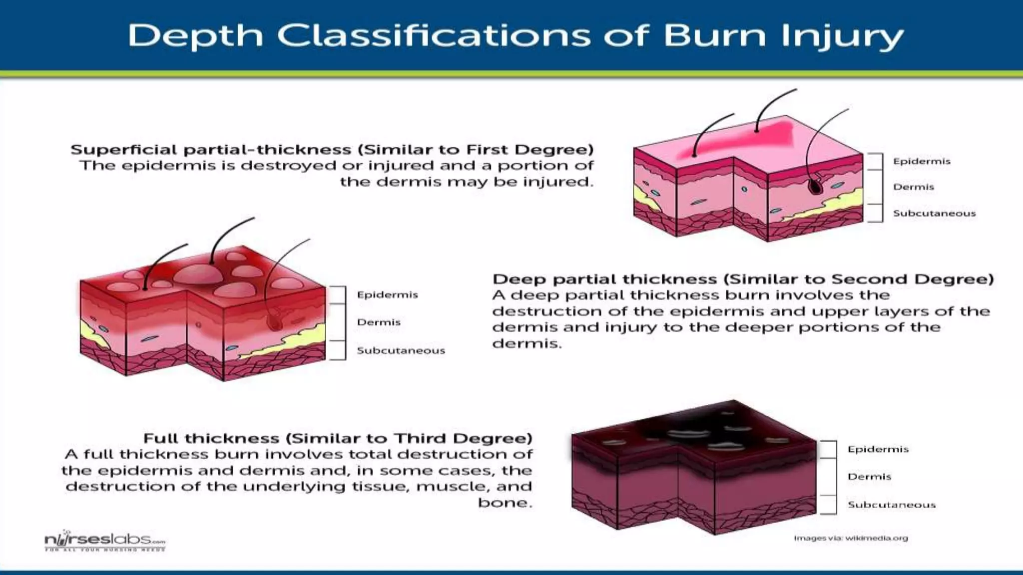 Nursing management of burn patient | PPTX