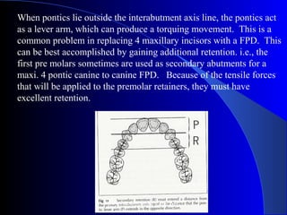 Abutment/ dental implant courses | PPT
