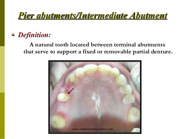Abutment evaluation / cosmetic dentistry training