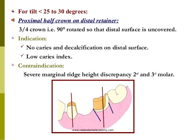 Abutment evaluation / cosmetic dentistry training