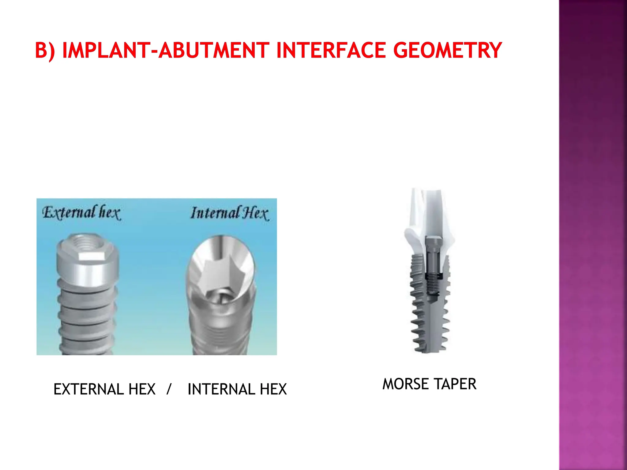 ABUTMENT SELECTION.pptx