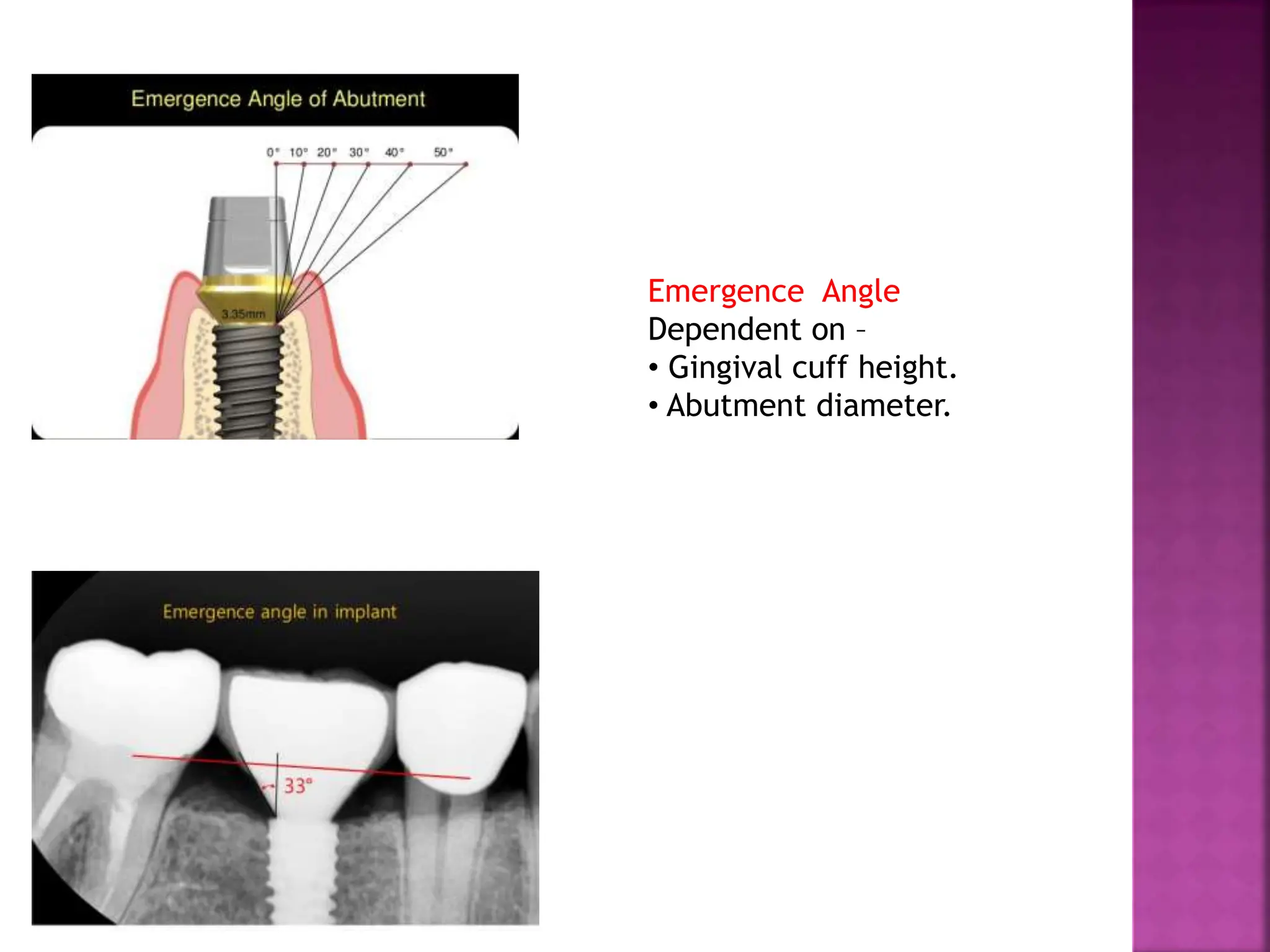 ABUTMENT SELECTION.pptx