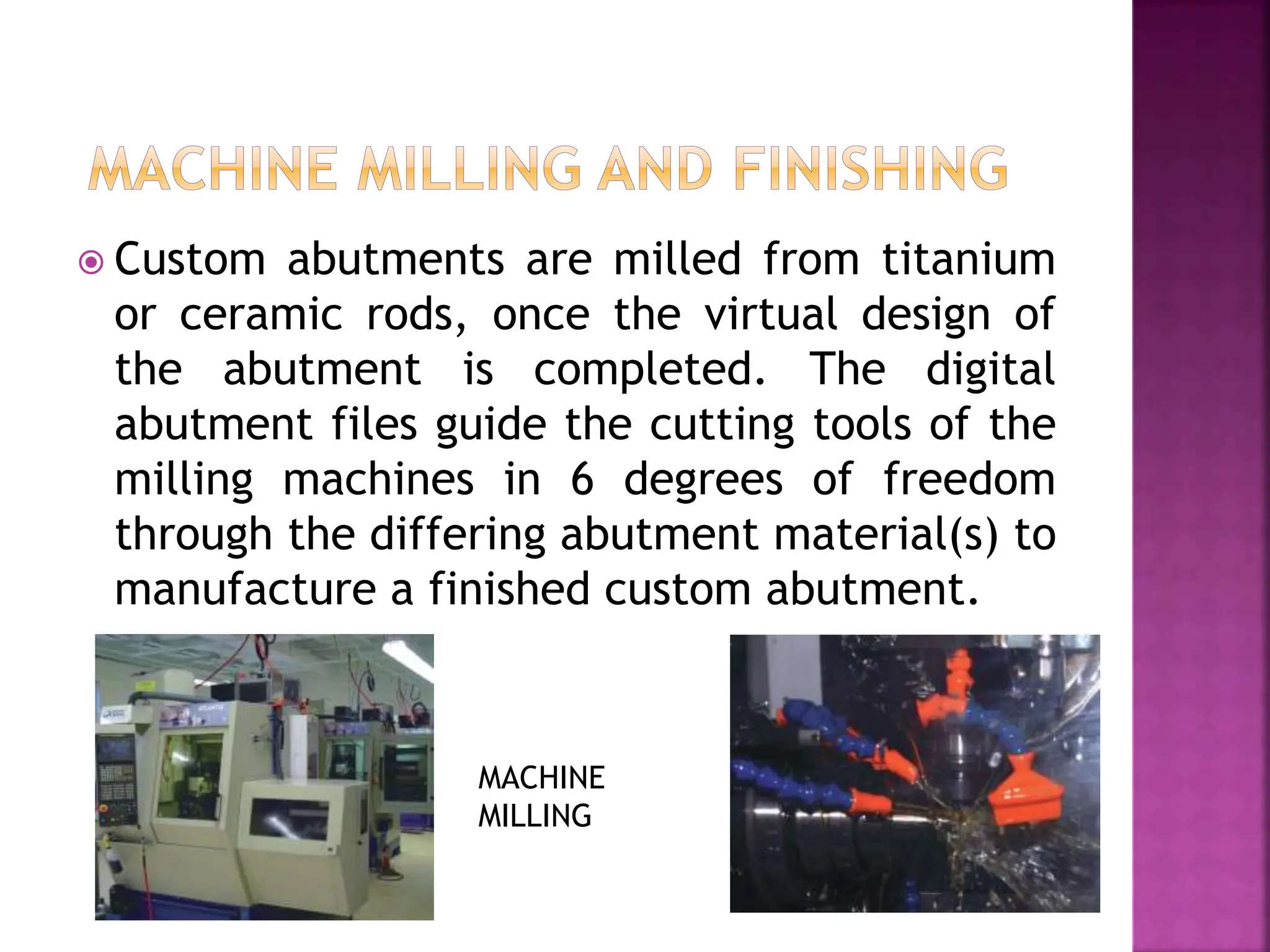 ABUTMENT SELECTION.pptx