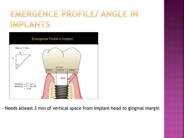 ABUTMENT SELECTION.pptx