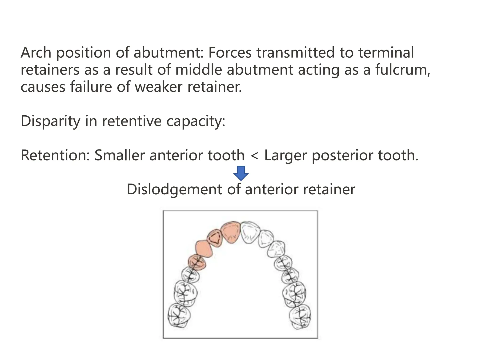 abutment selection in fixed partial denture.pptx