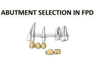 abutment selection in fixed partial denture.pptx