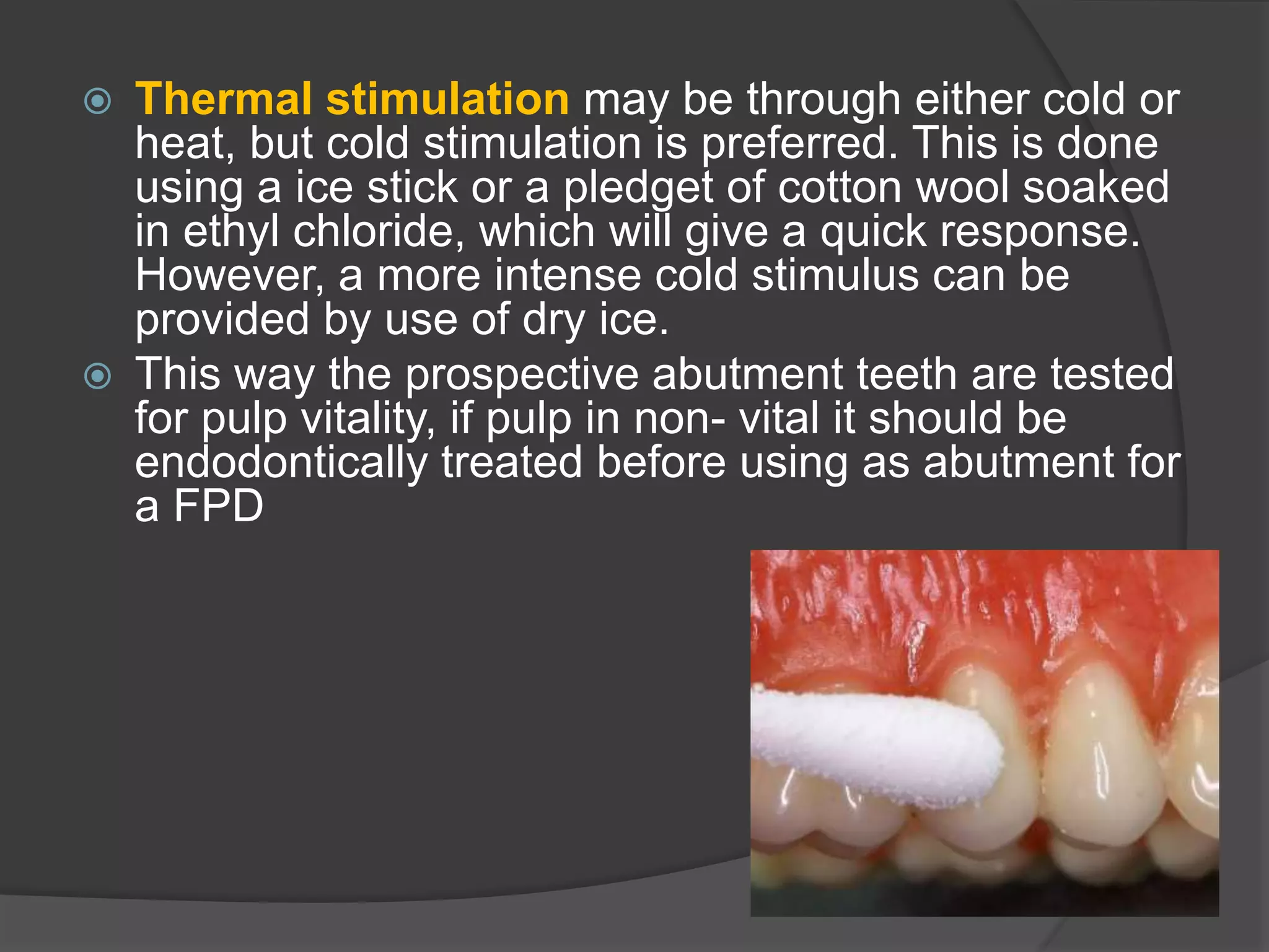 Abutment selection in fpd | PPTX