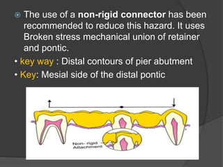 Abutment selection in fpd | PPT
