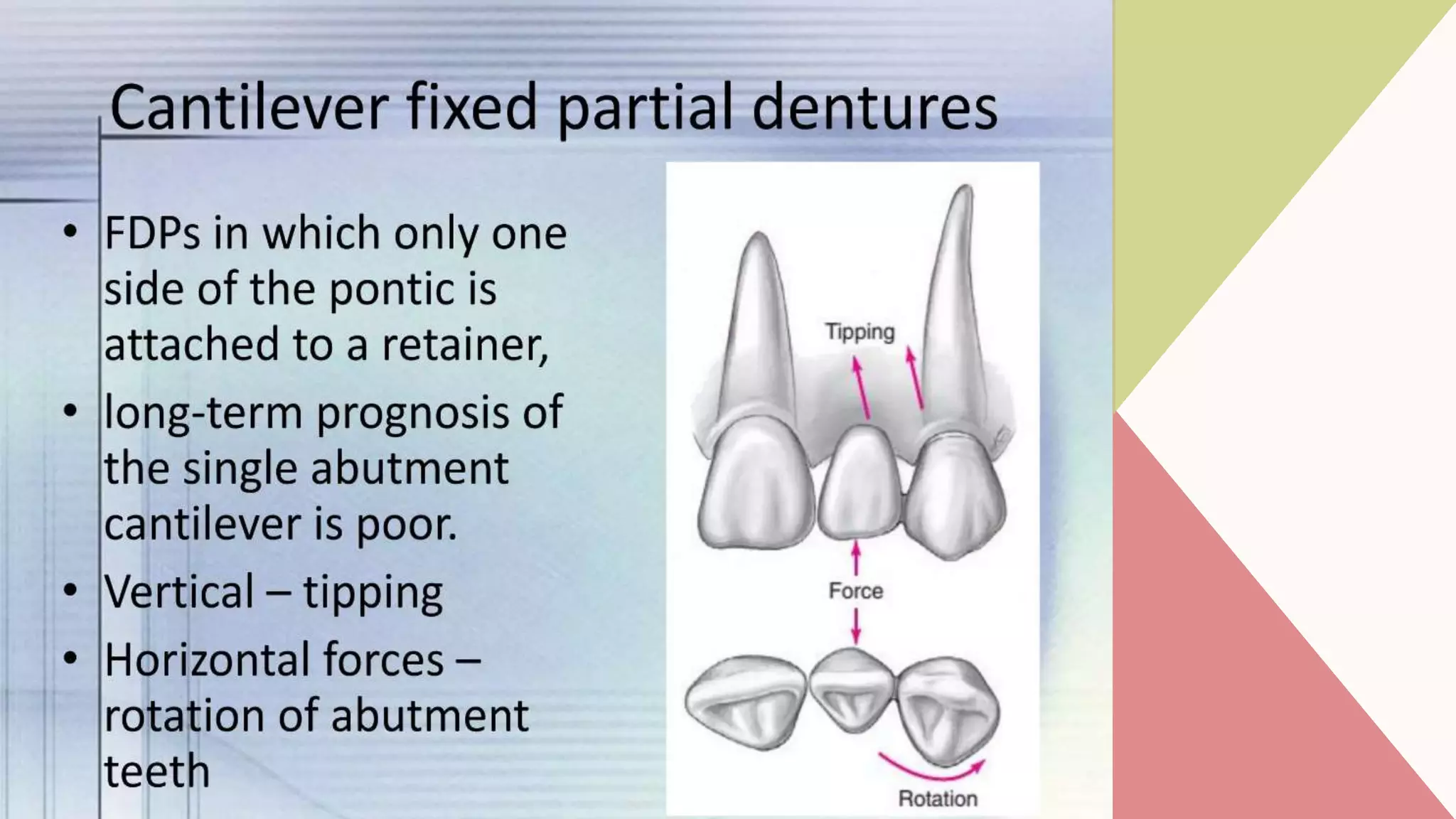 ABUTMENT SELECTION IN FPD.pptx