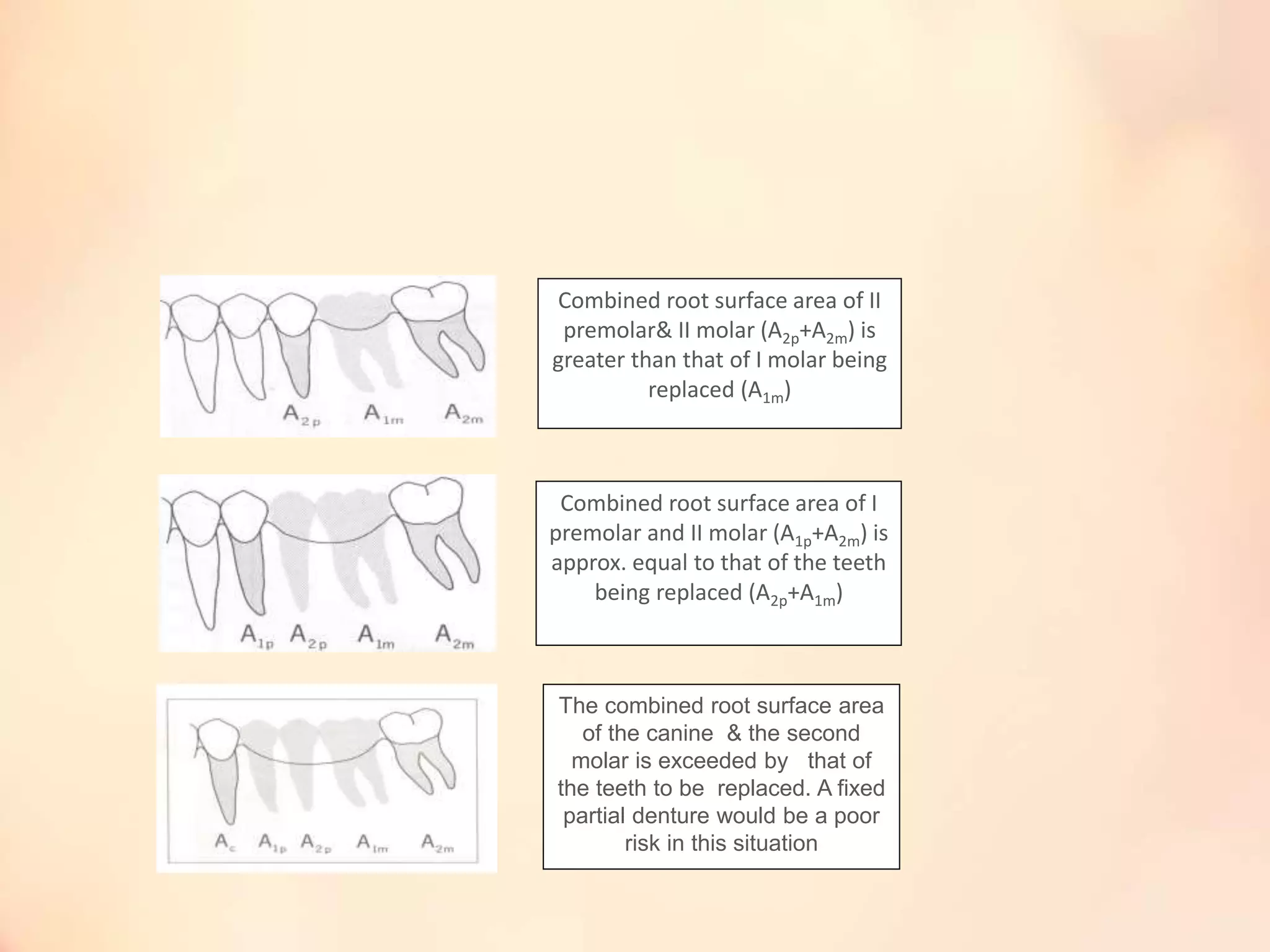 Abutment selection in FPD | PPTX