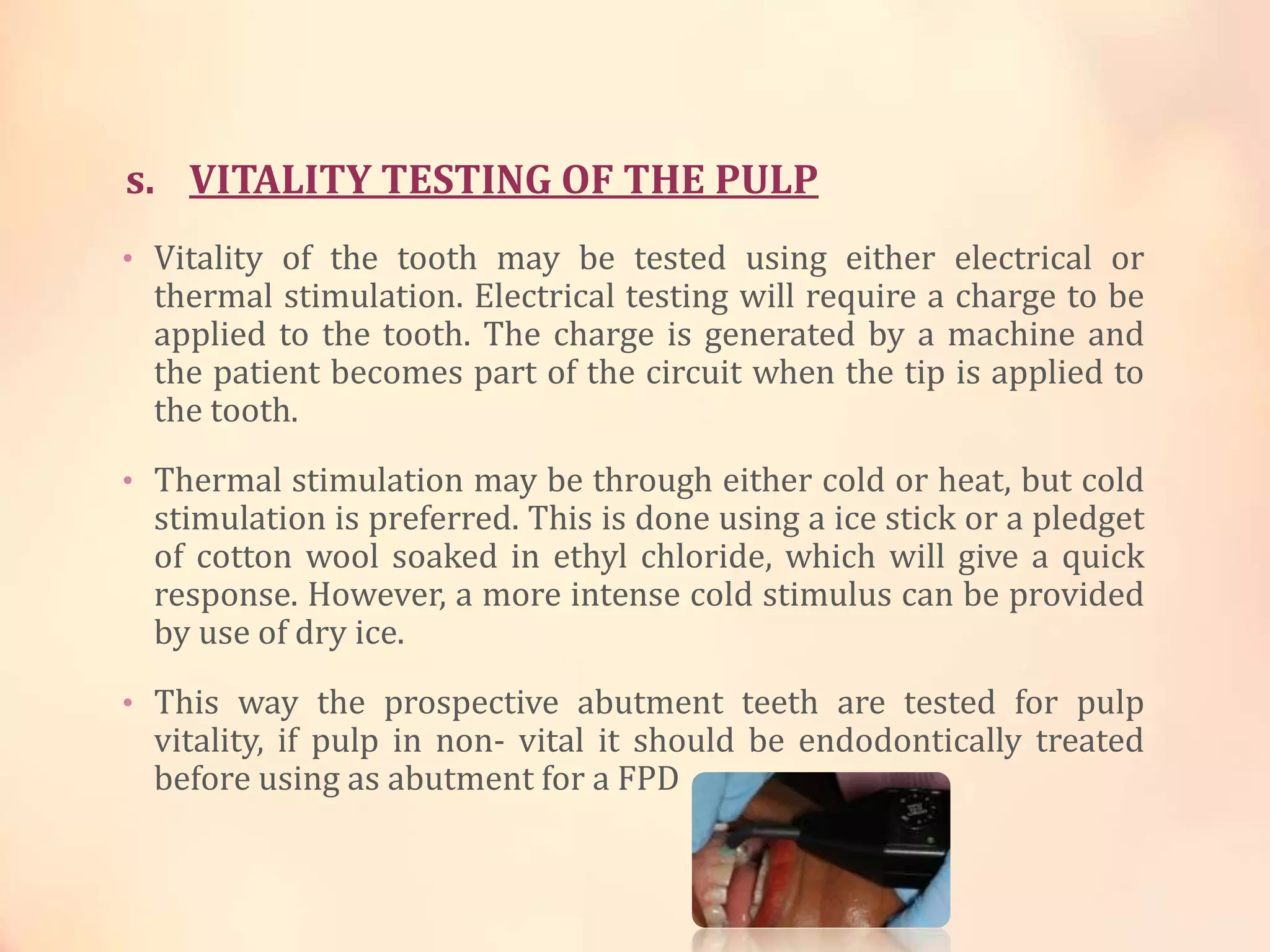 Abutment selection in FPD | PPTX