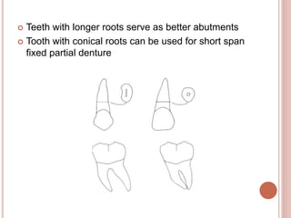 Selection of Abutment Teeth | PPTX