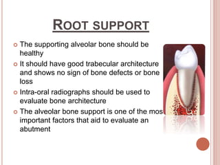Selection of Abutment Teeth | PPTX