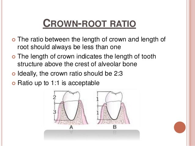 Selection of Abutment Teeth