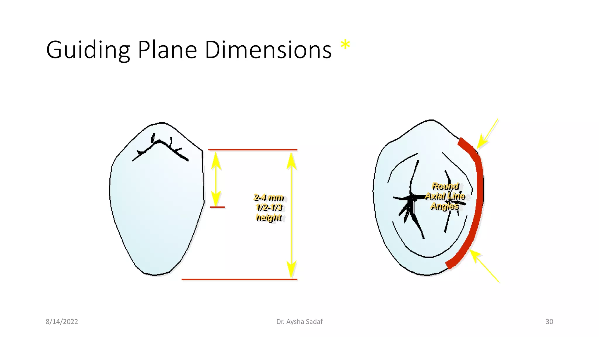ABUTMENT TOOTH PREPARATION.pptx