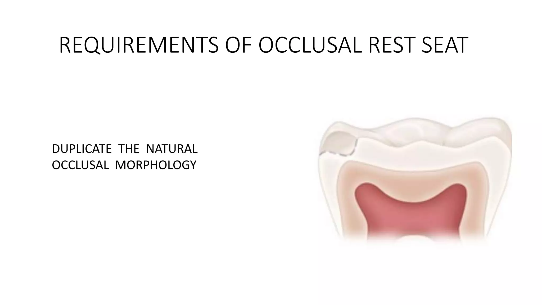 abutment tooth prep part 2.pptx