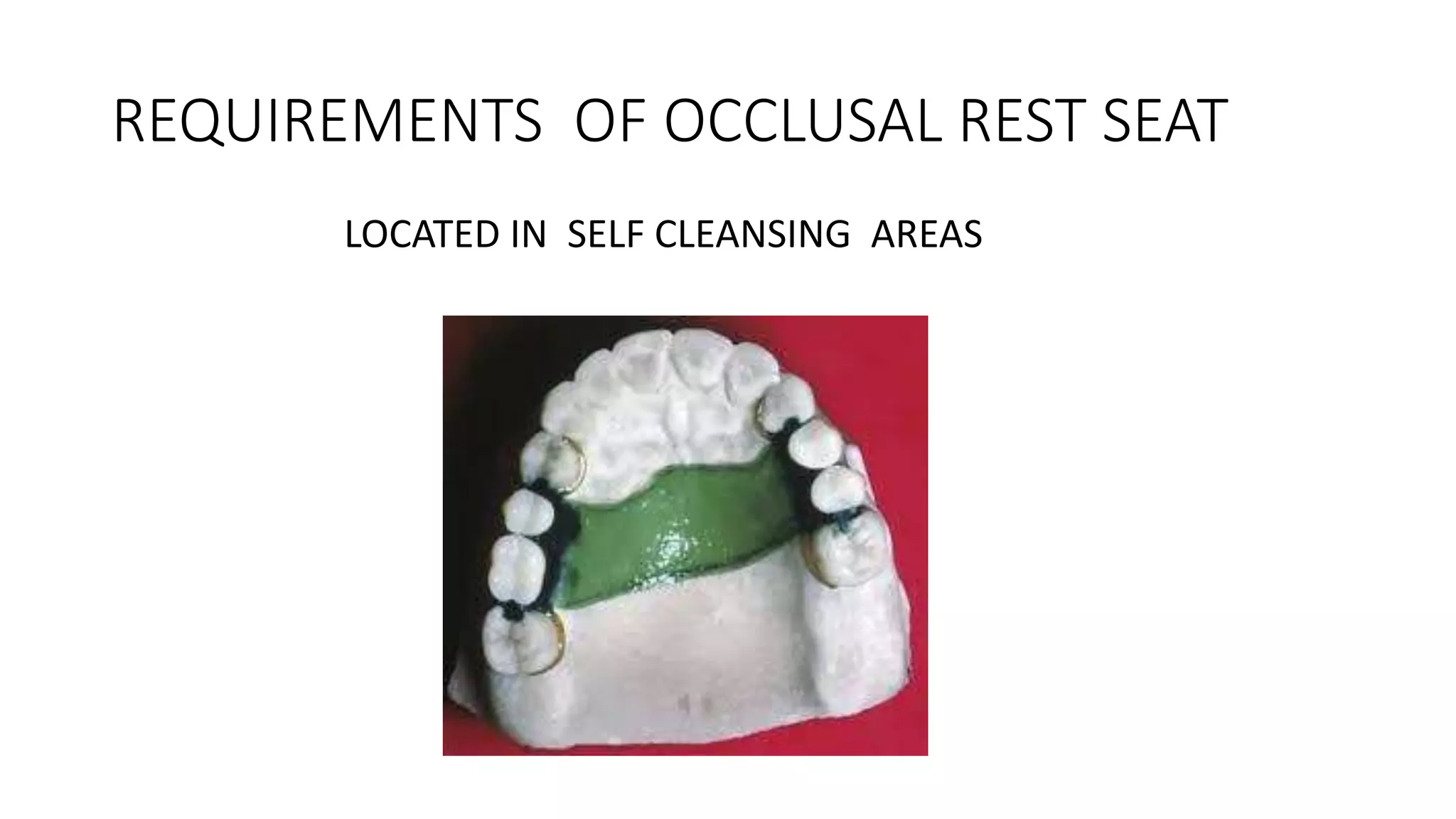 abutment tooth prep part 2.pptx