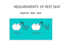 abutment tooth prep part 2.pptx