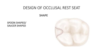 abutment tooth prep part 2.pptx