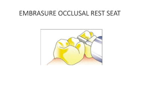 abutment tooth prep part 2.pptx