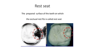 abutment tooth prep part 2.pptx