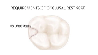 abutment tooth prep part 2.pptx