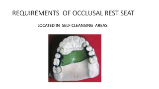 abutment tooth prep part 2.pptx