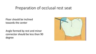 abutment tooth prep part 2.pptx