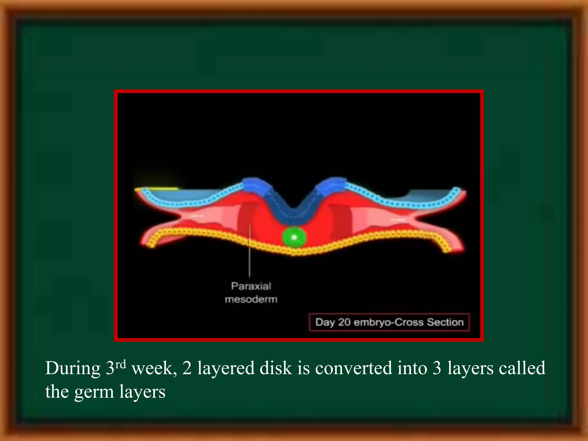 Abdominal wall defects | PPTX