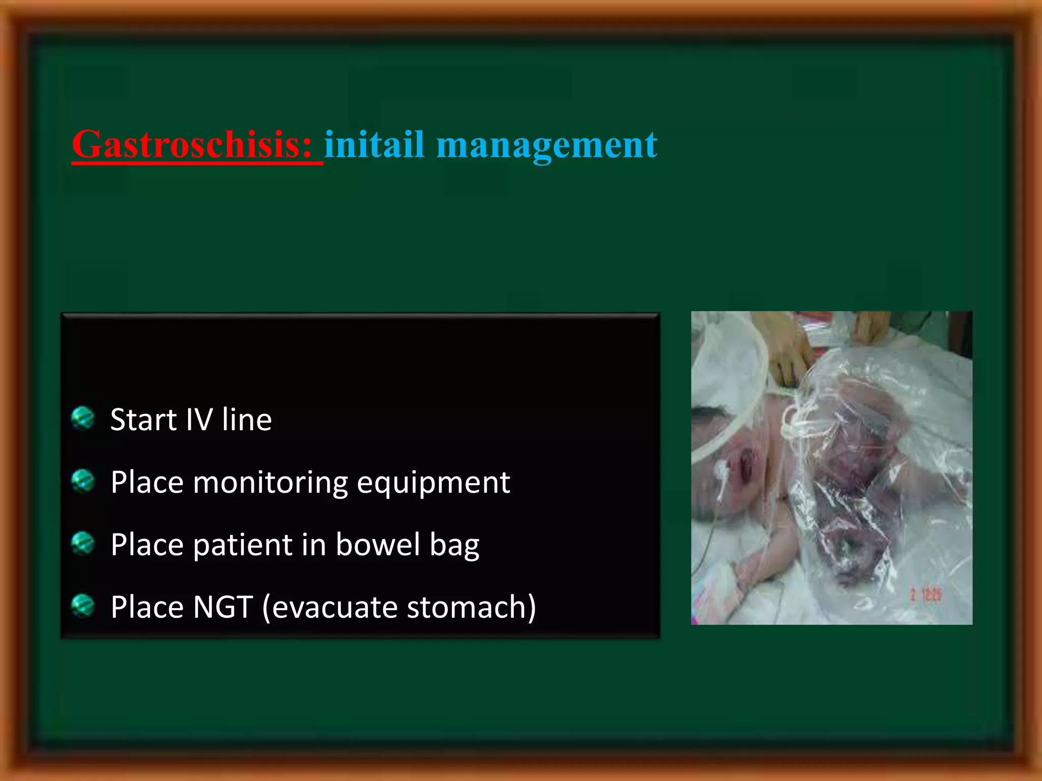 Abdominal Wall Defects Pptx Pregnancy Reproductive Health