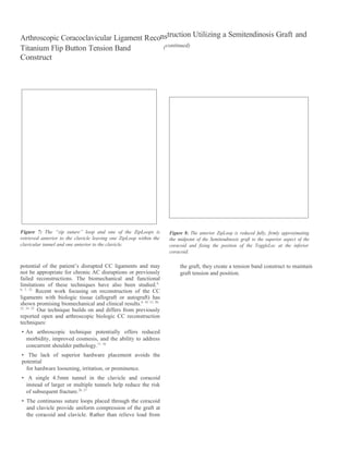 Ac shoulder-dislocation | DOC
