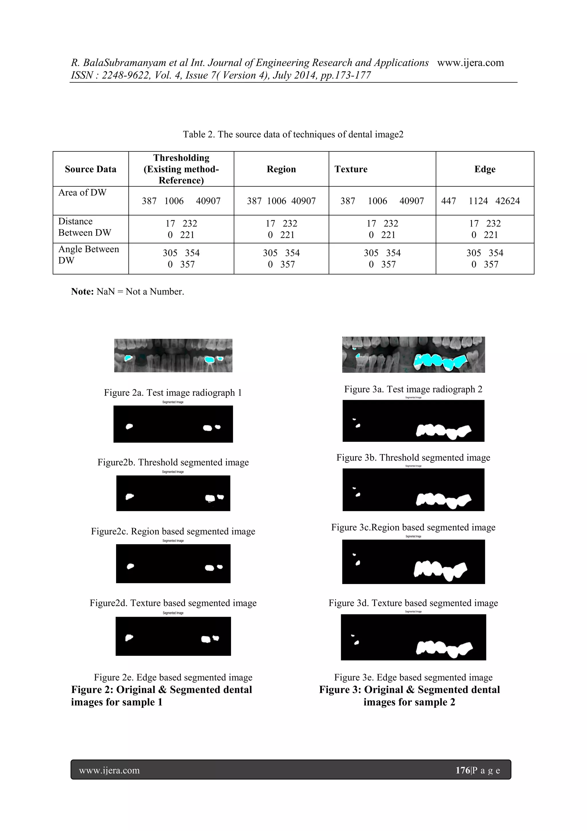 Different Image Segmentation Techniques for Dental Image Extraction | PDF