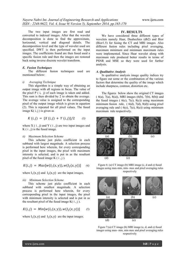 Medical Image Fusion Using Discrete Wavelet Transform | PDF