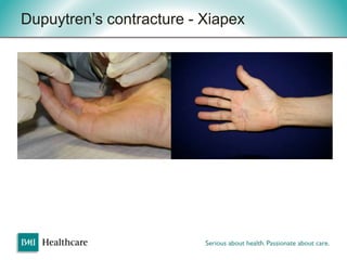 injection workshop 2105 | PPT