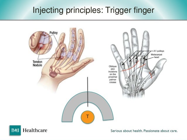 injection workshop 2105