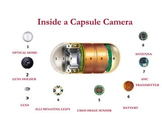 Pill Camera ppt | PPT